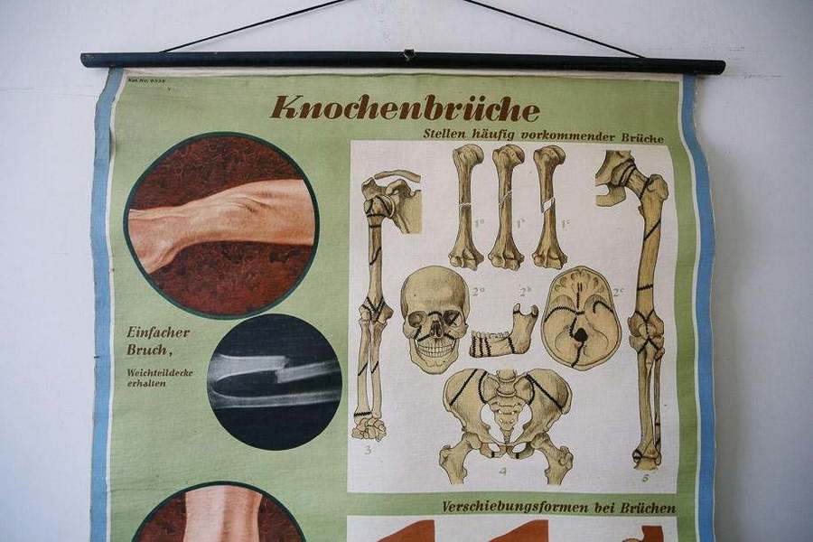 Original Anatomical Vintage German Educational School Wall Chart Bone ...