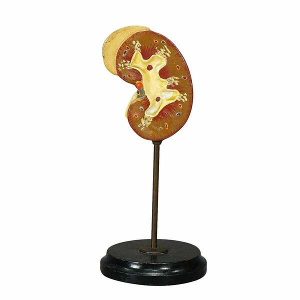 Antique Teaching Model Longitudinal Profile Of The Kidney, Ca. 1900 ...